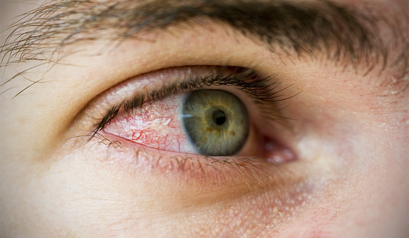 Office ergo – feeling the eye strain? - Washington Retail Association